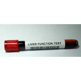 Liver Function Test